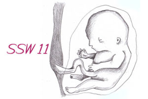 Schwangerschaftswoche 11